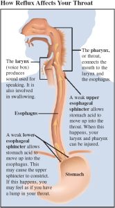 GASTRO-OESOPHAGEAL AND LARYNGOPHARYNGEAL REFLUX